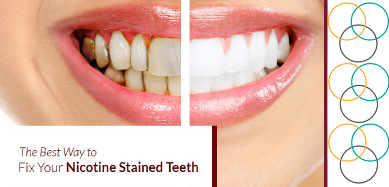The Best Way to Fix Your Nicotine Stained Teeth - Latest Dental News ...