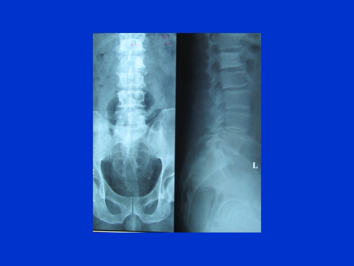 Kuching Urology古晉秘尿專科: Lower urinary tract symptoms LUTS and prostate ...