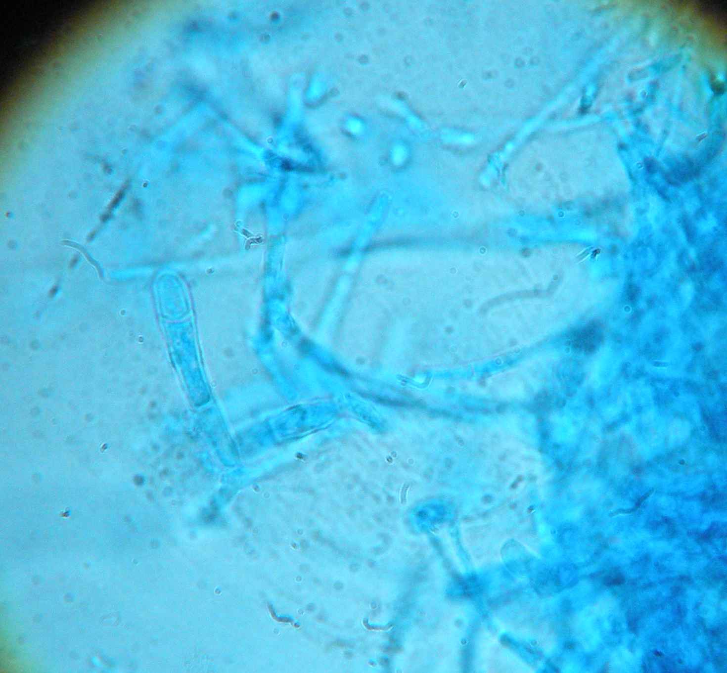 ATLAS MICOLOGIA: EPIDERMOPHYTON FLOCCOSUM