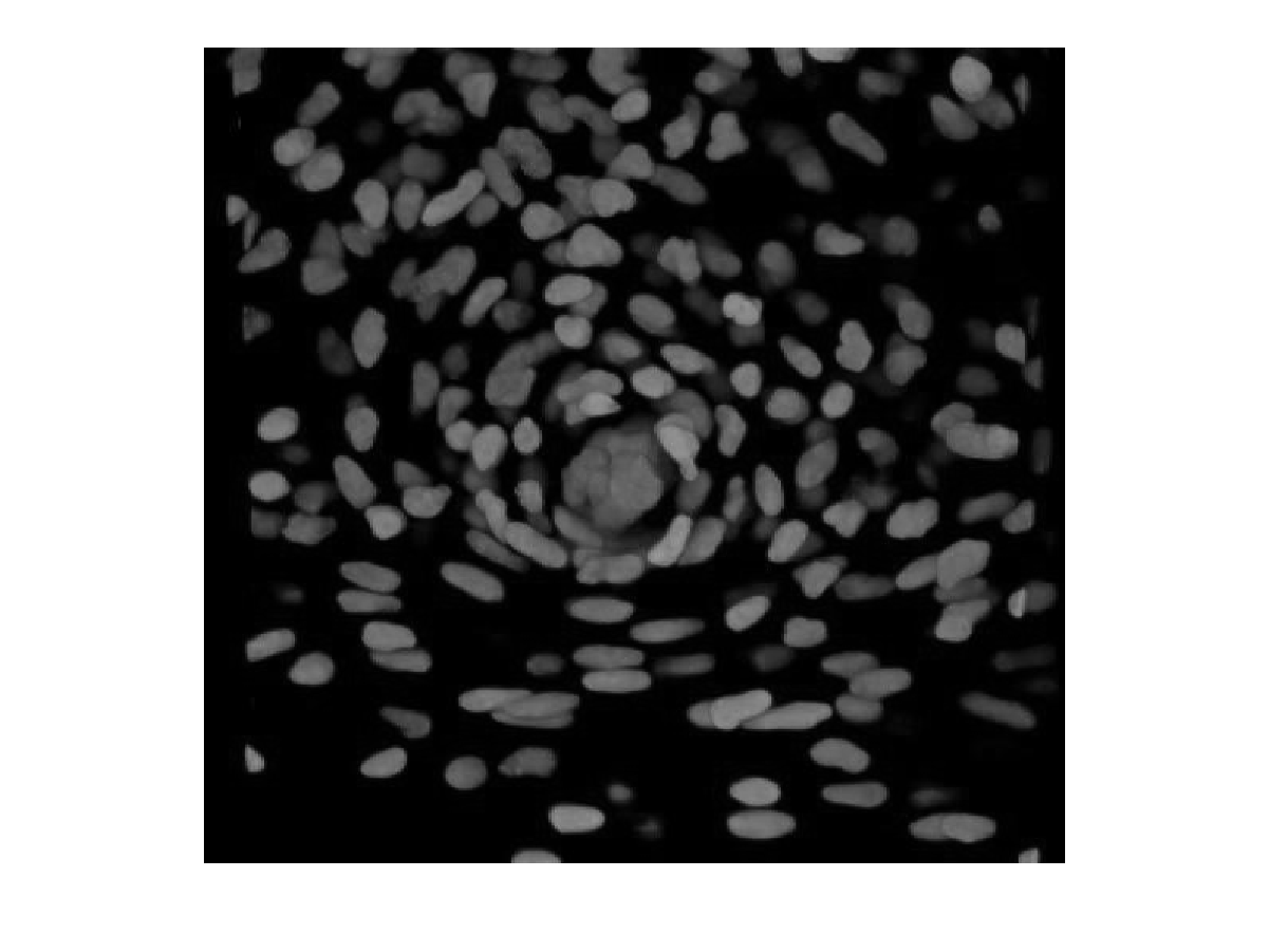 Basic cell counting and segmentation in Matlab