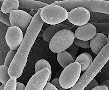 ΟΛΑ ΛΑΘΟΣ...: ΚΑΝΤΙΤΙΑΣΗ (Candidiasis) (Candida albicans)