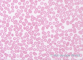 Microscope World Blog: Wright's Stain for Microscopy