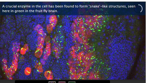 Curious Microscopic "Snakes" Invading Human Cells