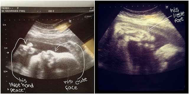 37 weeks - Him & Her