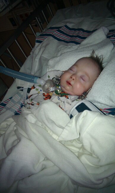 Bodie's Blog: Jaw Distraction Surgery