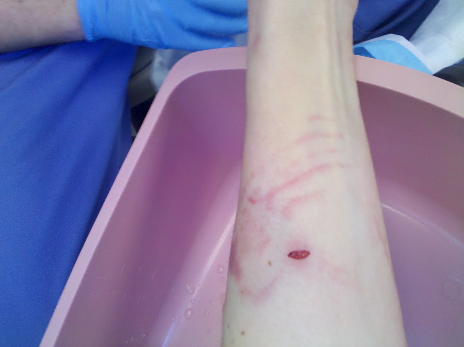 Evolution Dog Training: Proof of Bite Inhibition