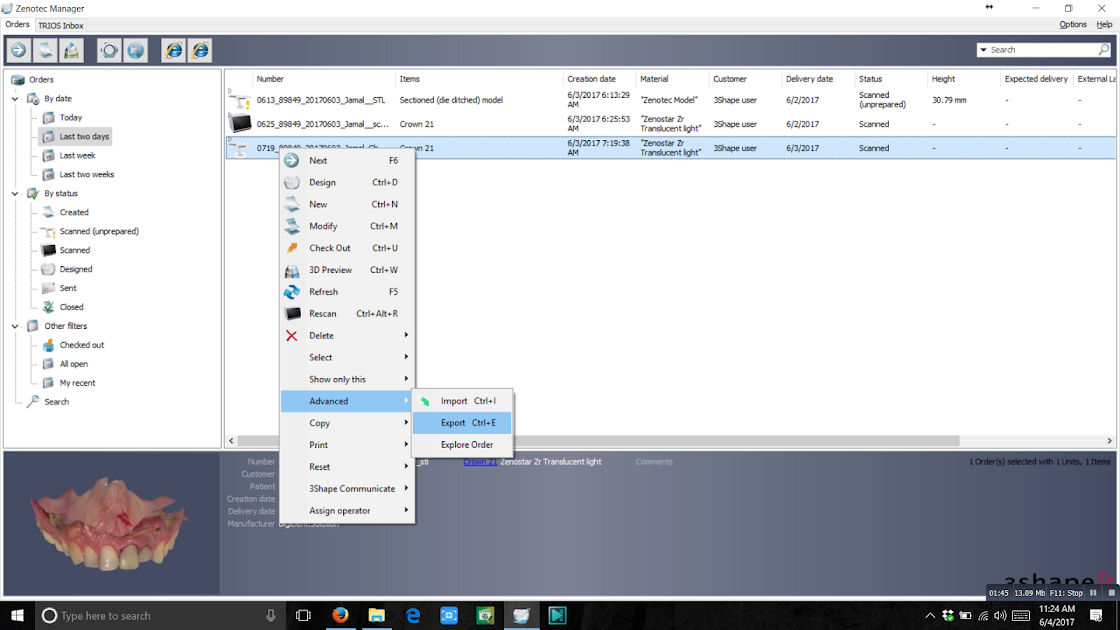 convert stl files into dcm with 3shape dental systen