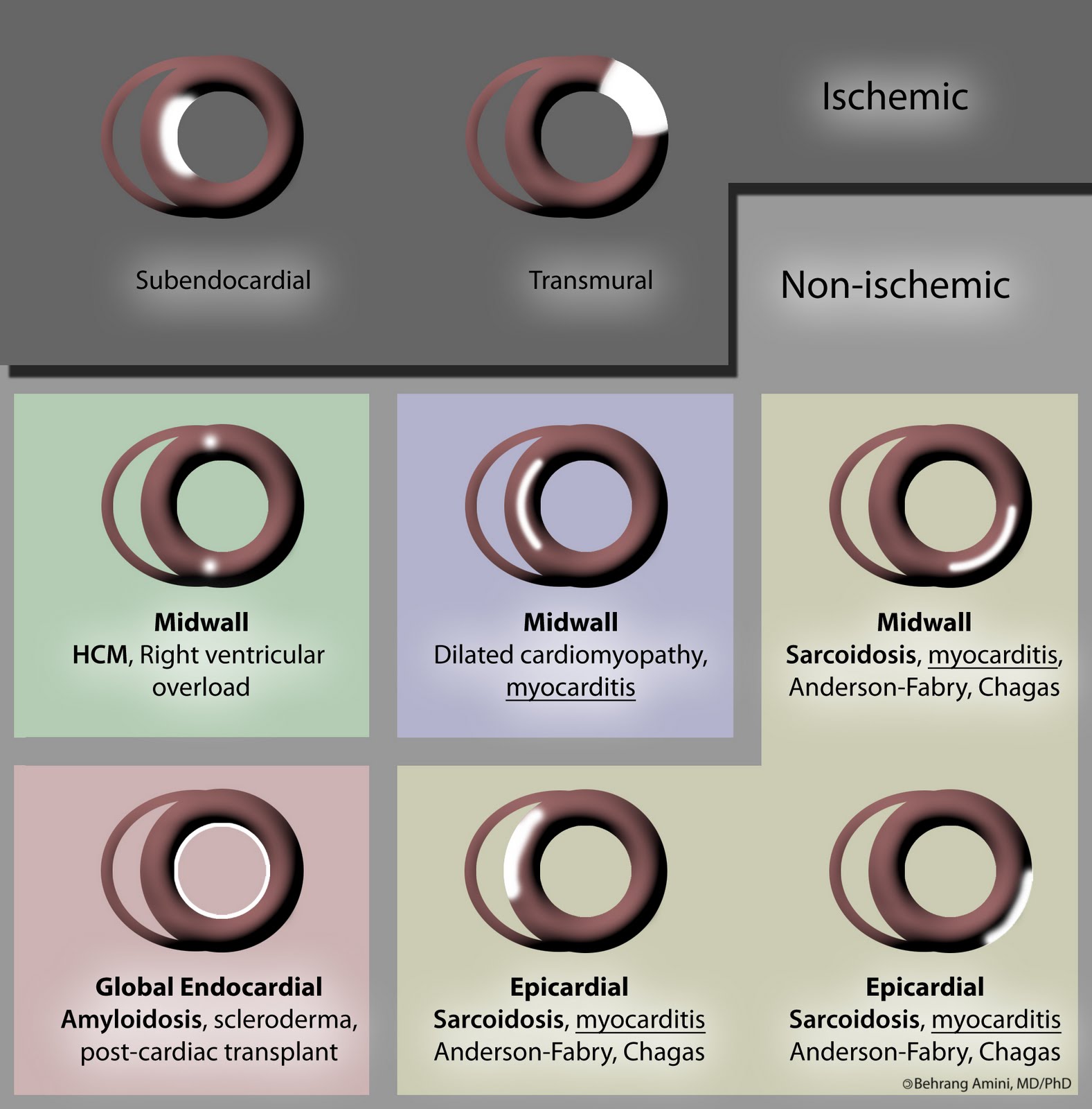 Roentgen Ray Reader: Patterns of Delayed Hyperenhancement