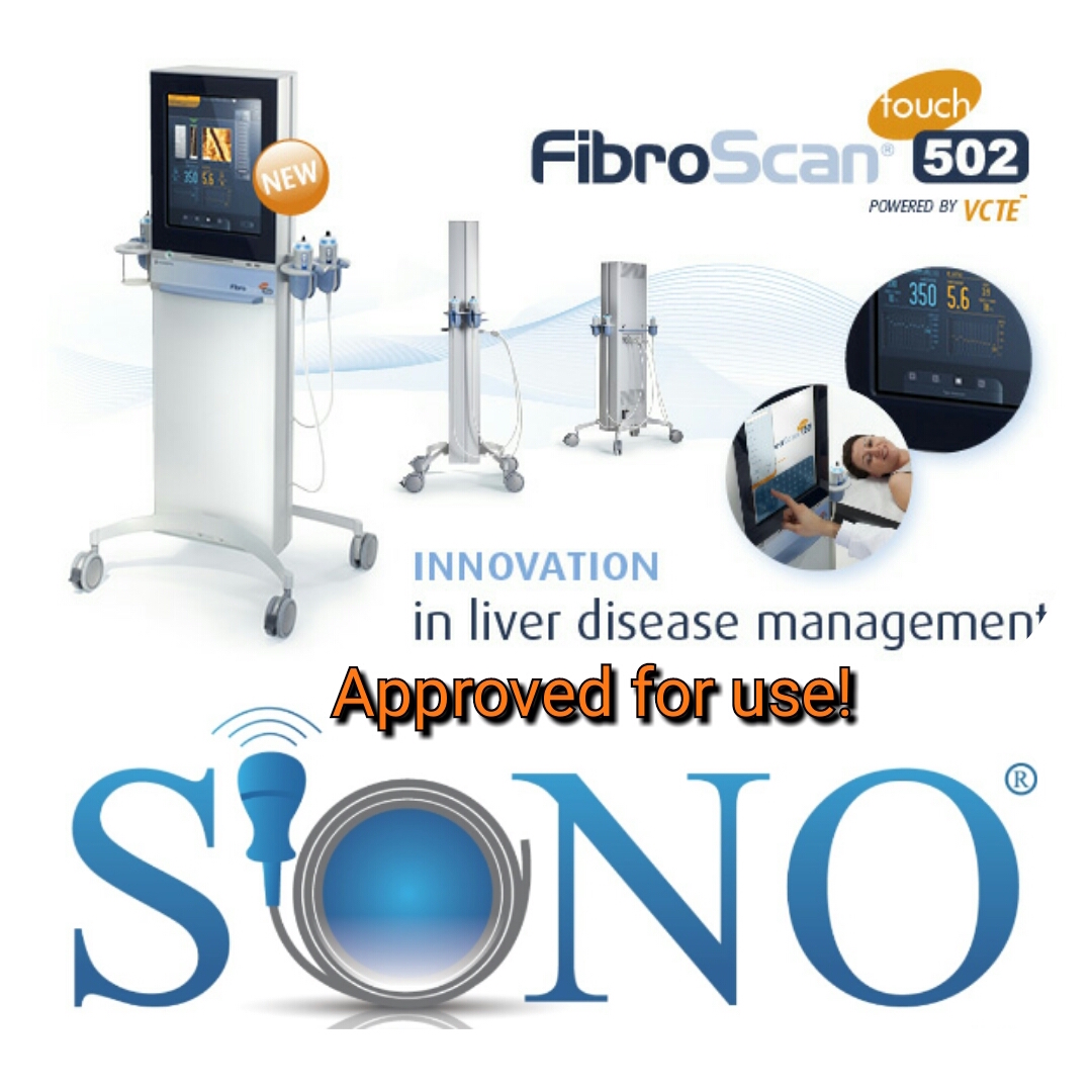 SONO Ultrasound Wipes: SONO Ultrasound Wipes