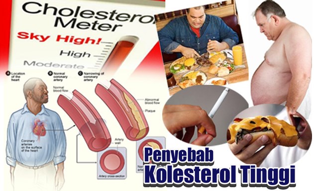 Informasi Tentang Penyakit Kolesterol: 2016
