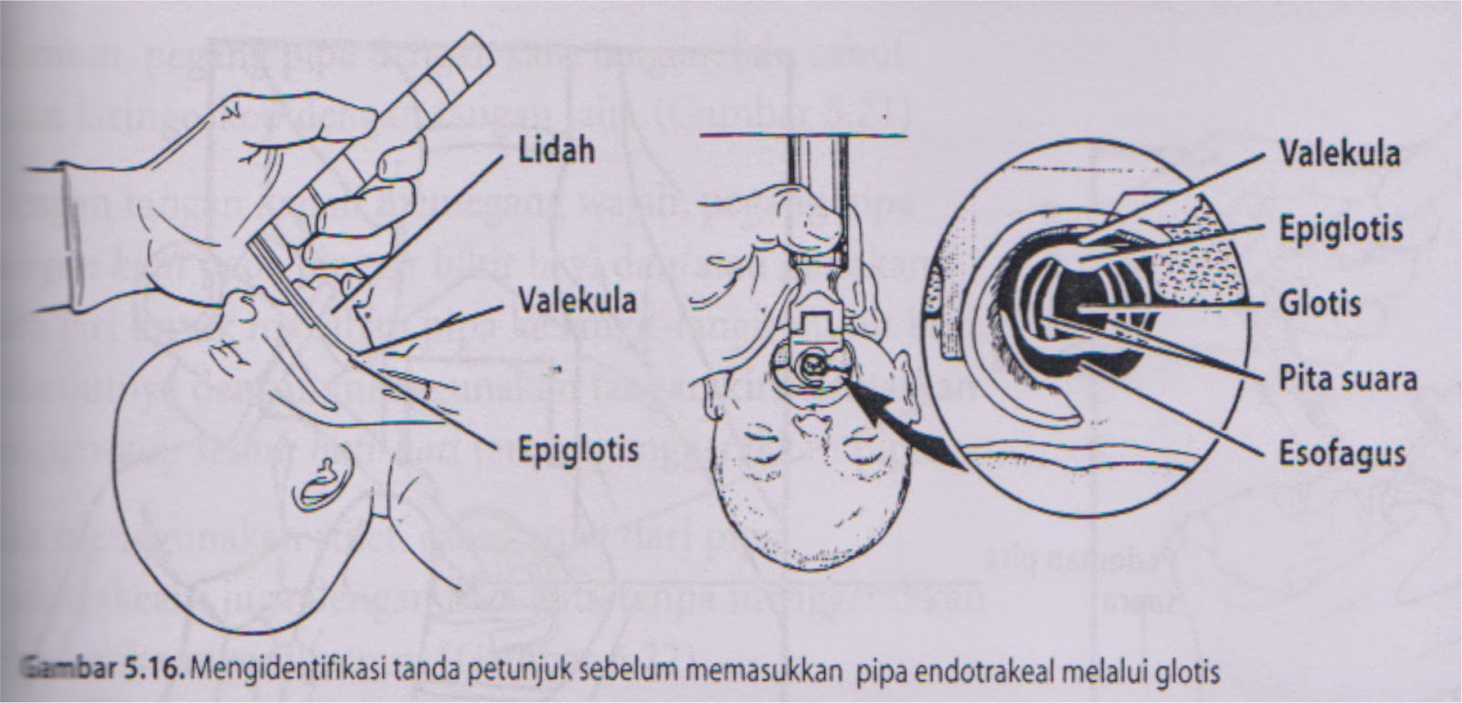 Mariana Dewani Harahap: RESUSITASI NEONATUS