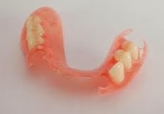 ¨ C'est une prothèse quiremplace une ou plusieurs dents de la mâchoire.