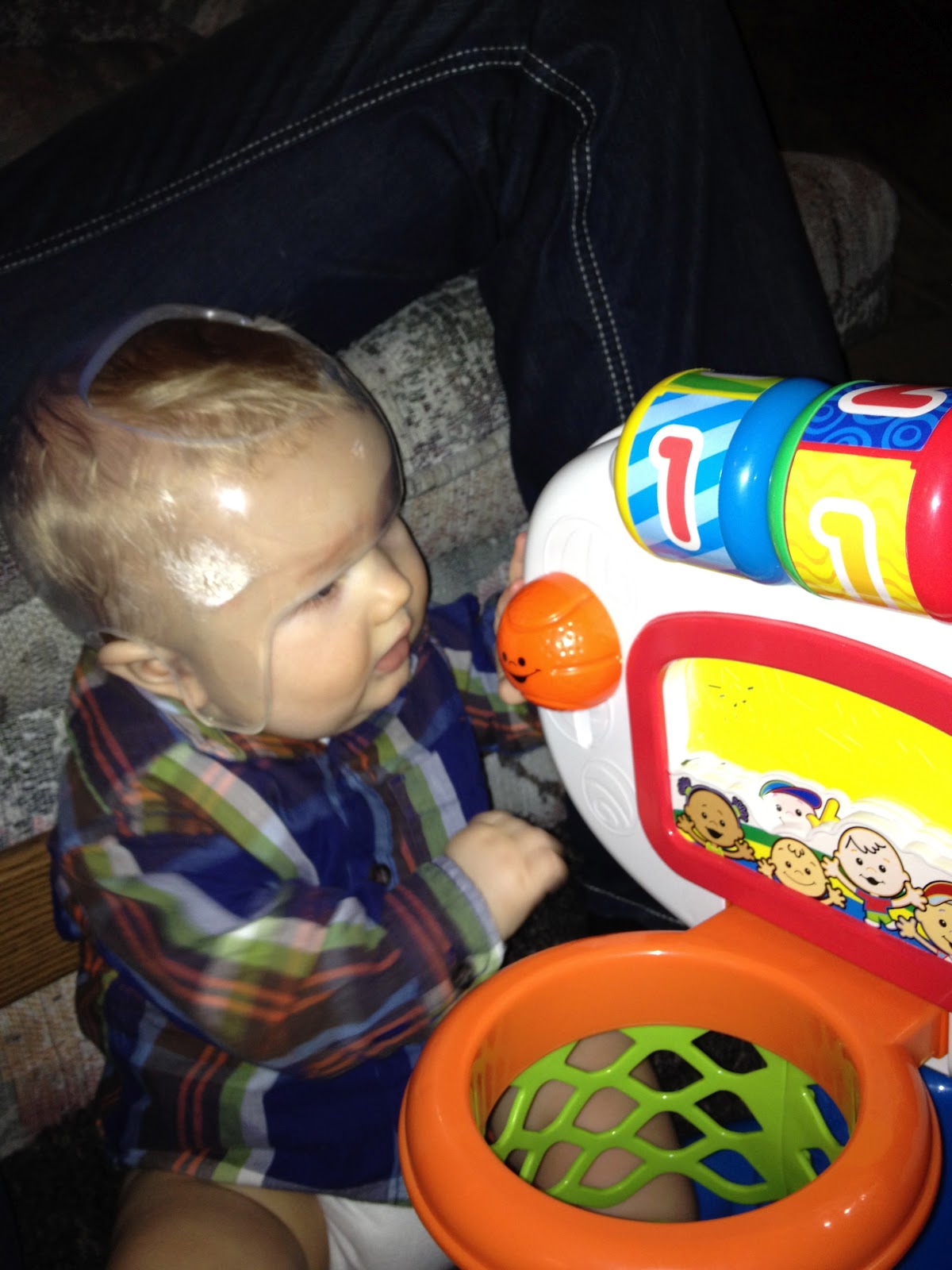 Duce Family: Brachycephaly