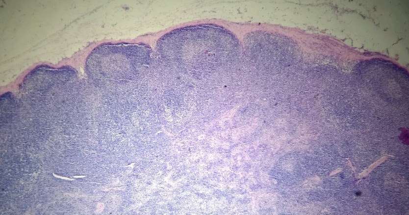 Manual interactivo de tejido conectivo: Tejido conectivo colágeno ...