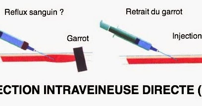 L'injection intraveineuse directe (IVD) | Récap' IDE