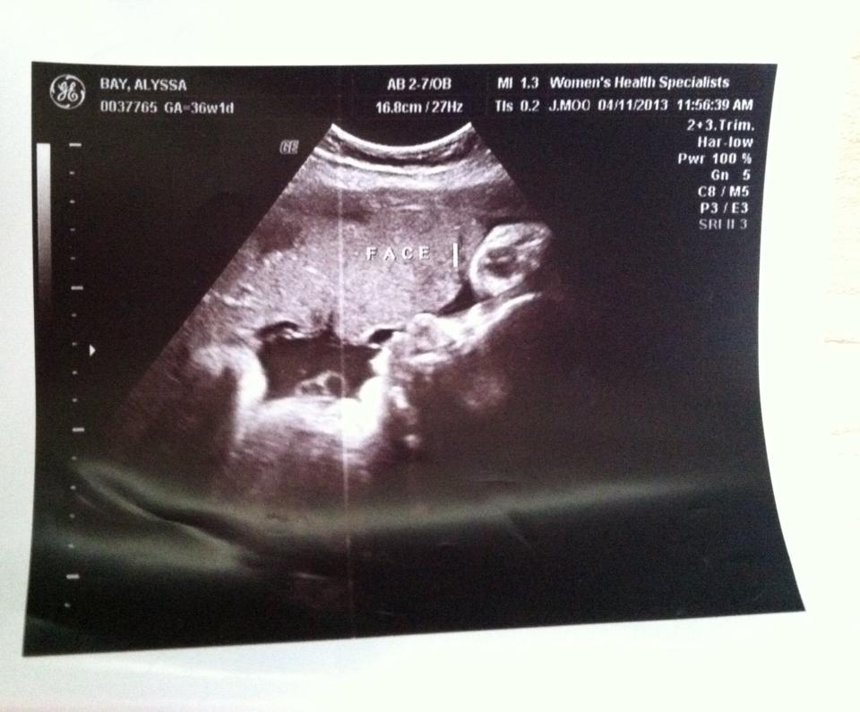 Life with Alyssa: 36 weeks pregnant!