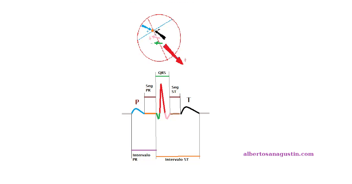 ECG normal (13): Intervalo PR (dimensiones y alteraciones) | Dr ...