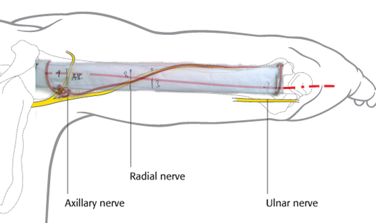 My knots and ties: Radial nerve rotation