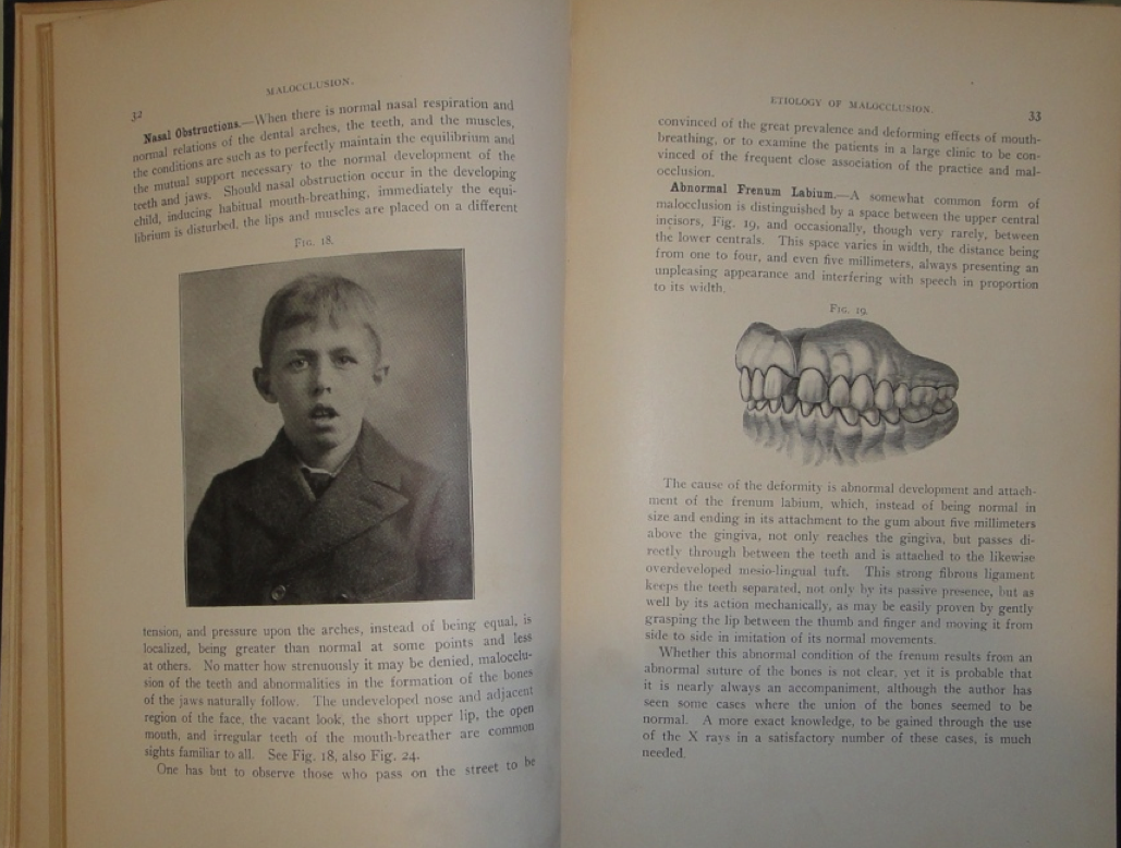 ORTODONTIA CONTEMPORÂNEA: Livro clássico com 112 anos, do Professor ...