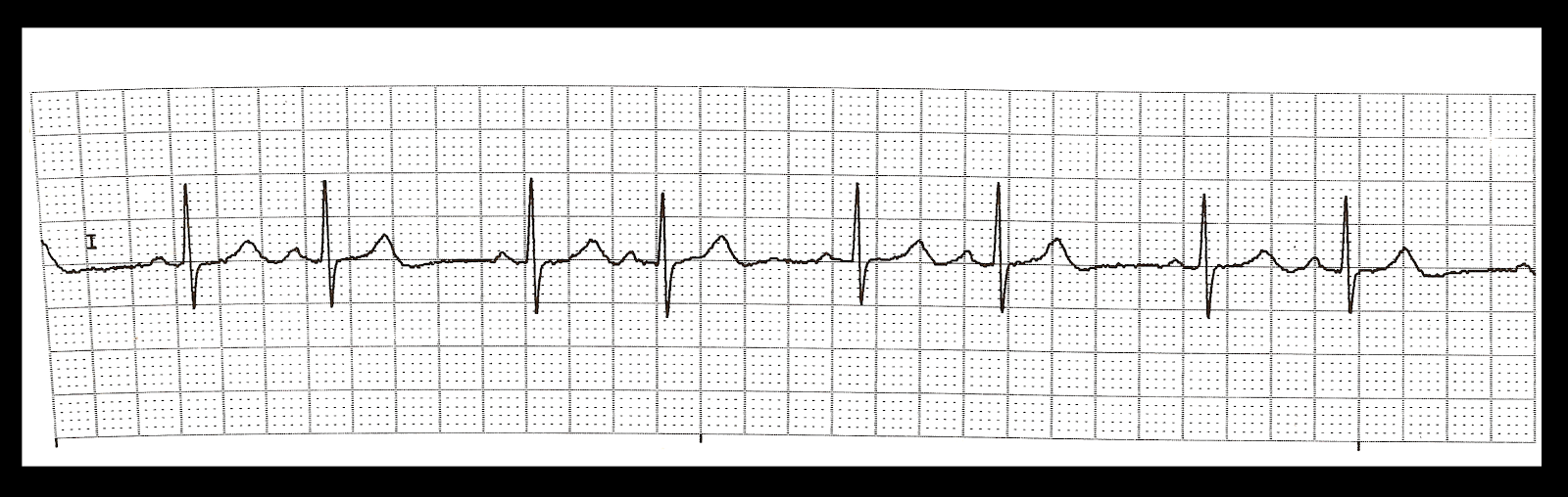 Float Nurse: Practice EKG Strips 350