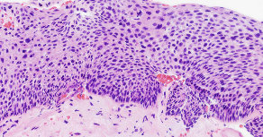 The Immortal Life of Henrietta Lacks NHS: Richard Wesley TeLinde
