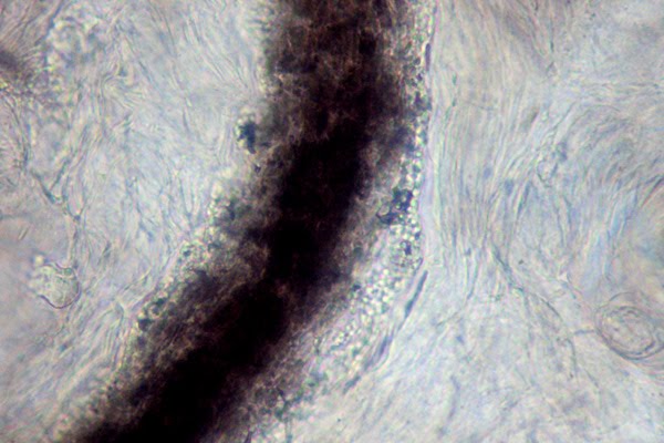 PATOLOGIA CLÍNICA VETERINÁRIA: Dermatofitose - raspado de pele
