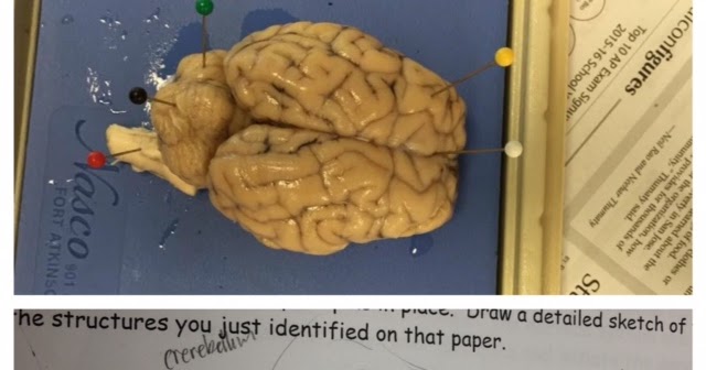 the Wang's Blog: Brains (dissection)