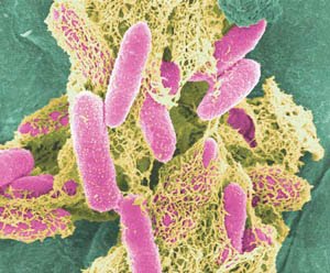 E Coli: How To Protect Yourself - Health information and tips