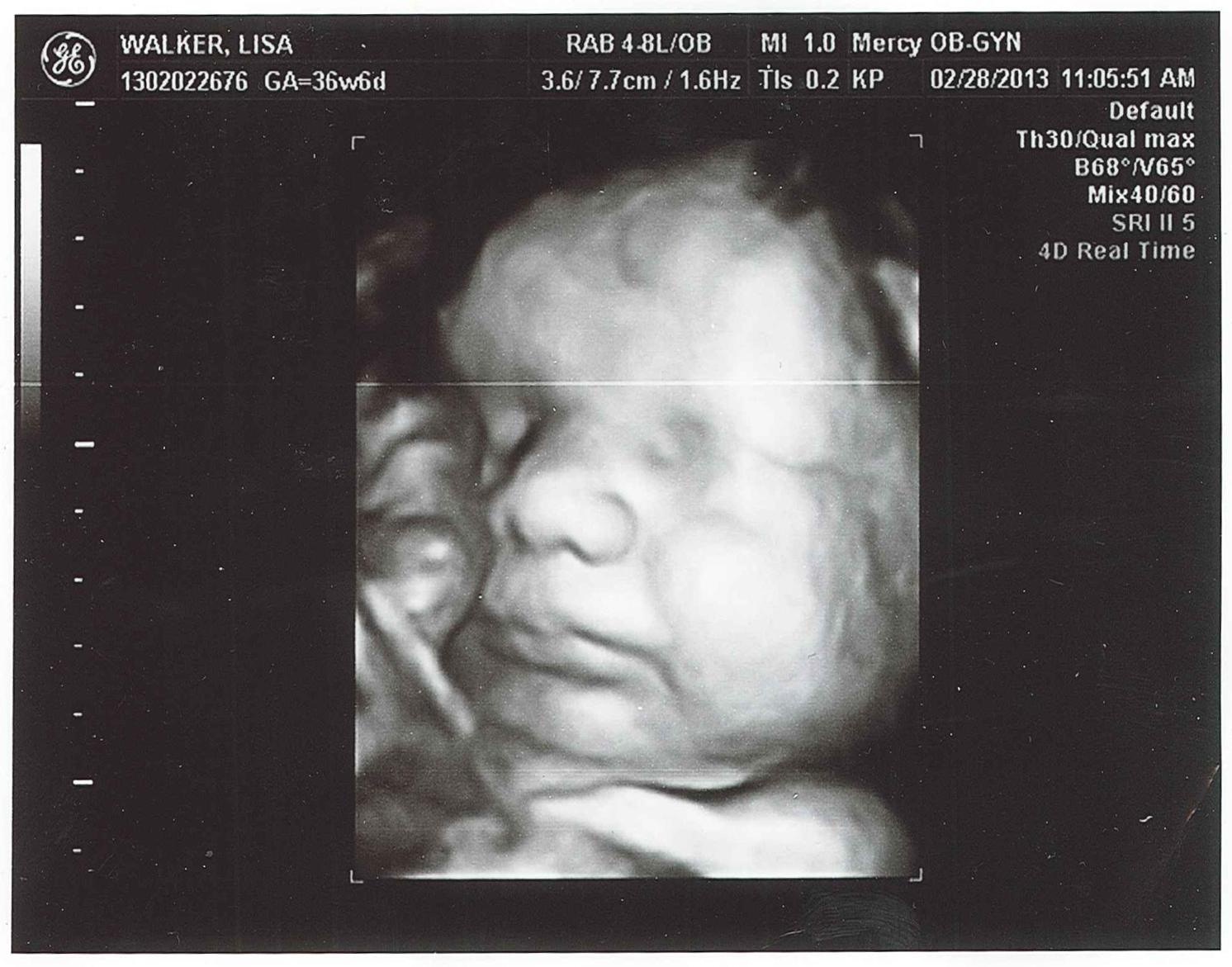 Pages From the Pursuit: Photos: Baby Boy Ultrasound at 37 weeks