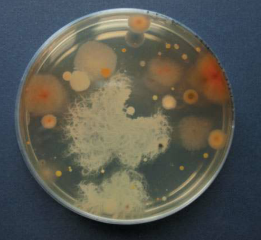 Noi della classe quinta C Ciari: Muffe: la scoperta di Fleming