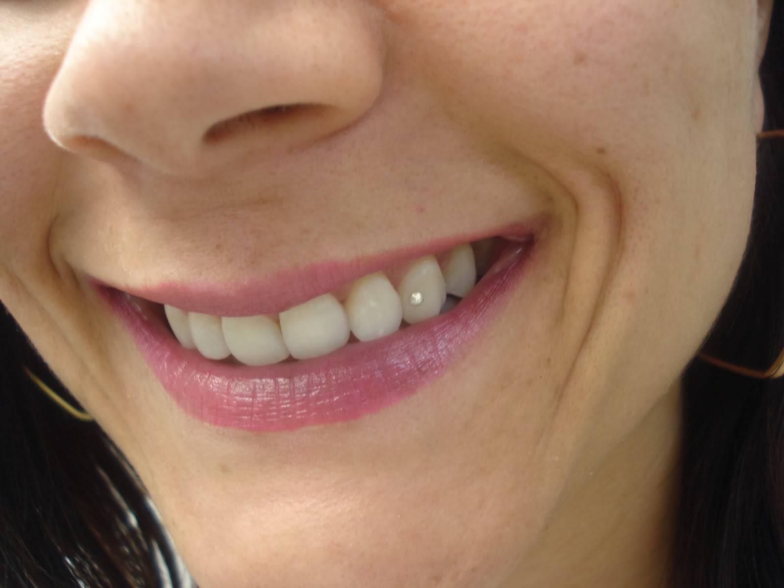 Ortodontia Pinhais, Dr Marcio Matos: PIERCING DENTAL