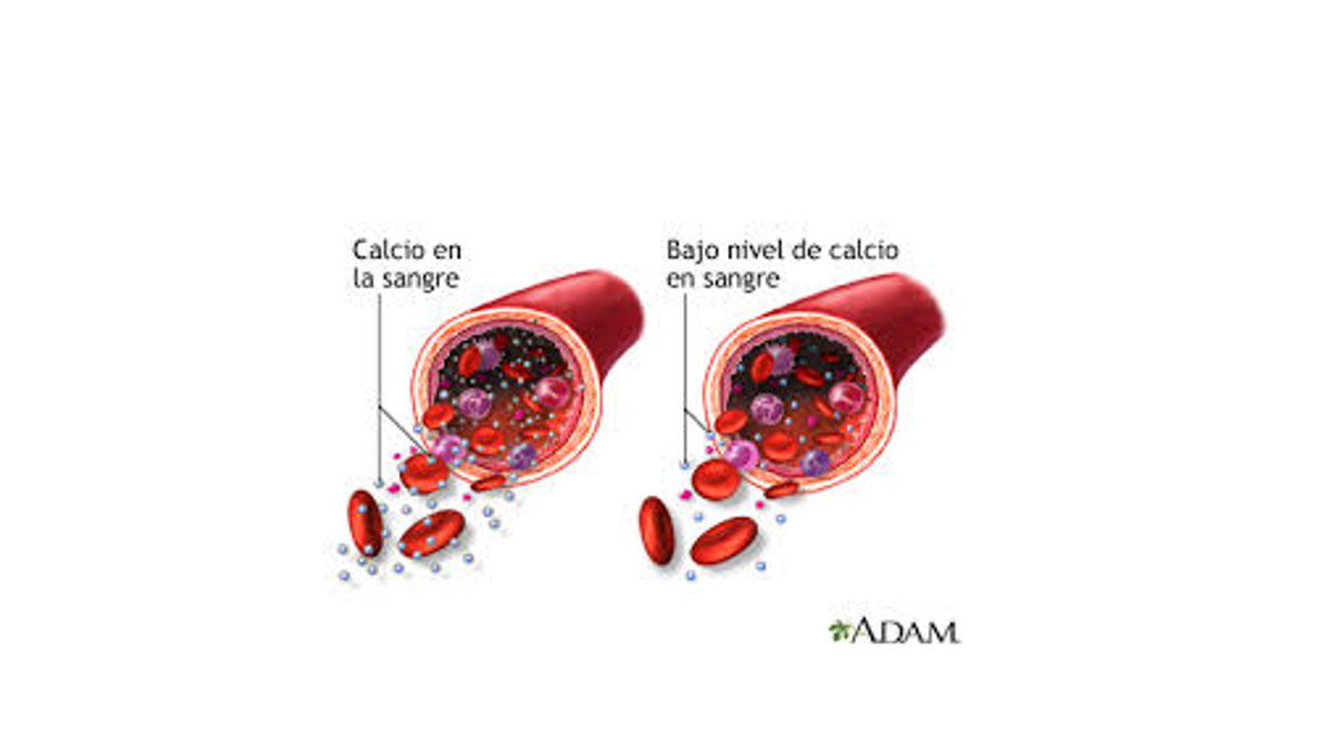 Qué es la Hipocalcemia : Síntomas, Causas Y Tratamiento