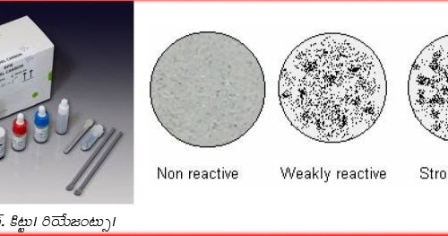 VDRL TEST - Microbiology Laboratory Turkey