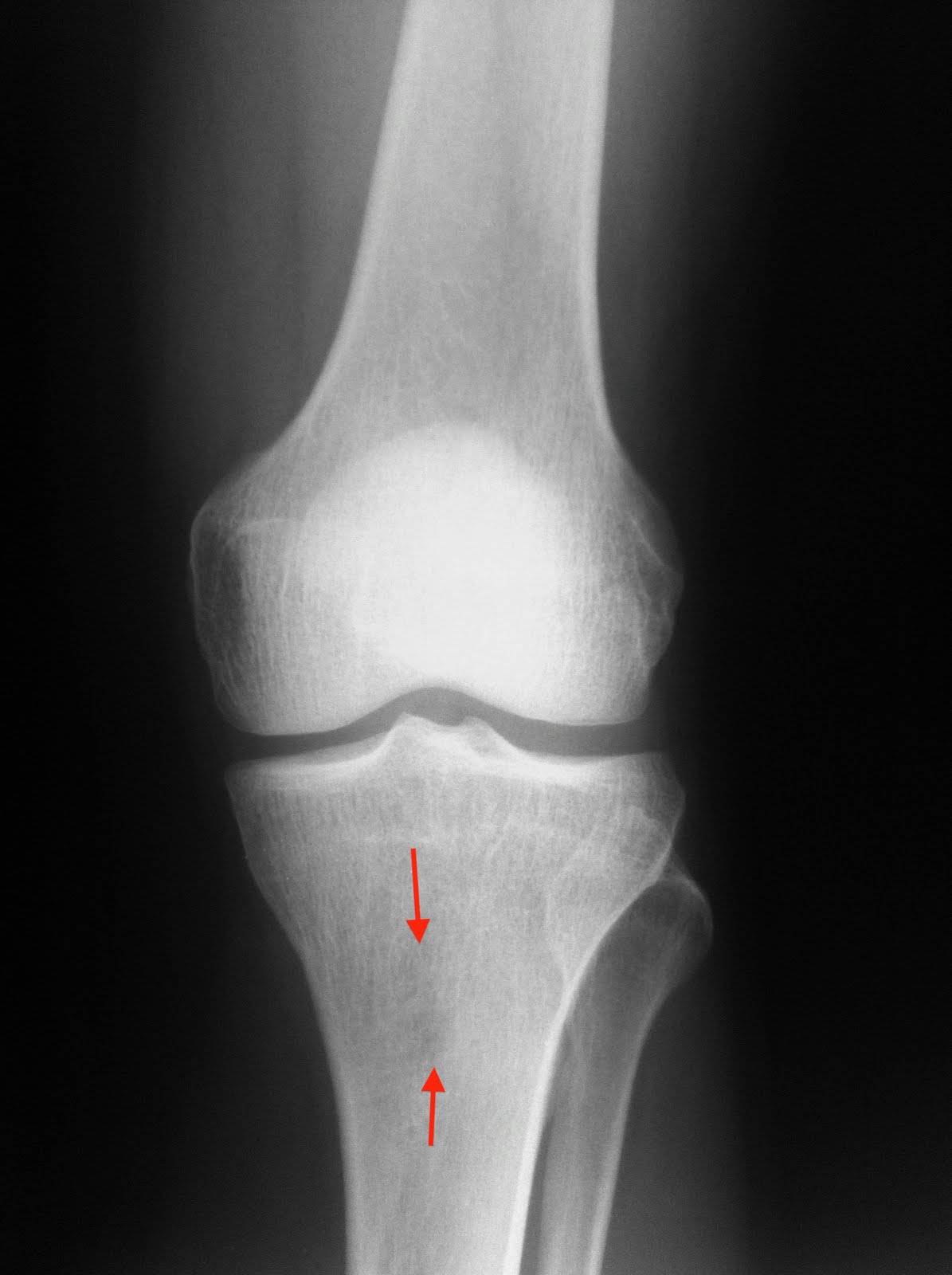 MedView Medical Imaging Consultancy Info Page: Limitation of plain ...
