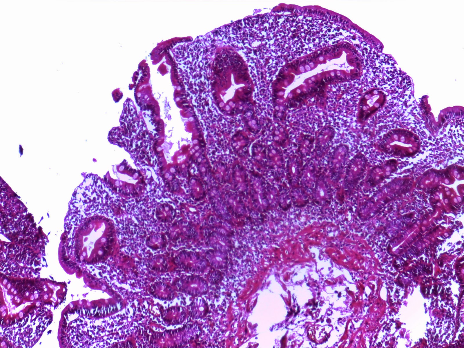 GASTROINTESTINAL AND LIVER HISTOLOGY PATHOLOGY ATLAS: DUODENUM: VILLOUS ...