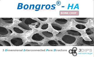 DAEWOONG PHARMA PHILIPPINES PRODUCTS: BONGROS - HA Bone Chip : Optimum ...