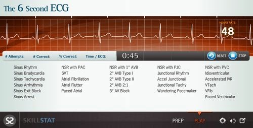 The SIX second ECG Simulator | booksmedicos