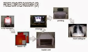 ZONA RADIOLOGY: Computed Radiography (CR)
