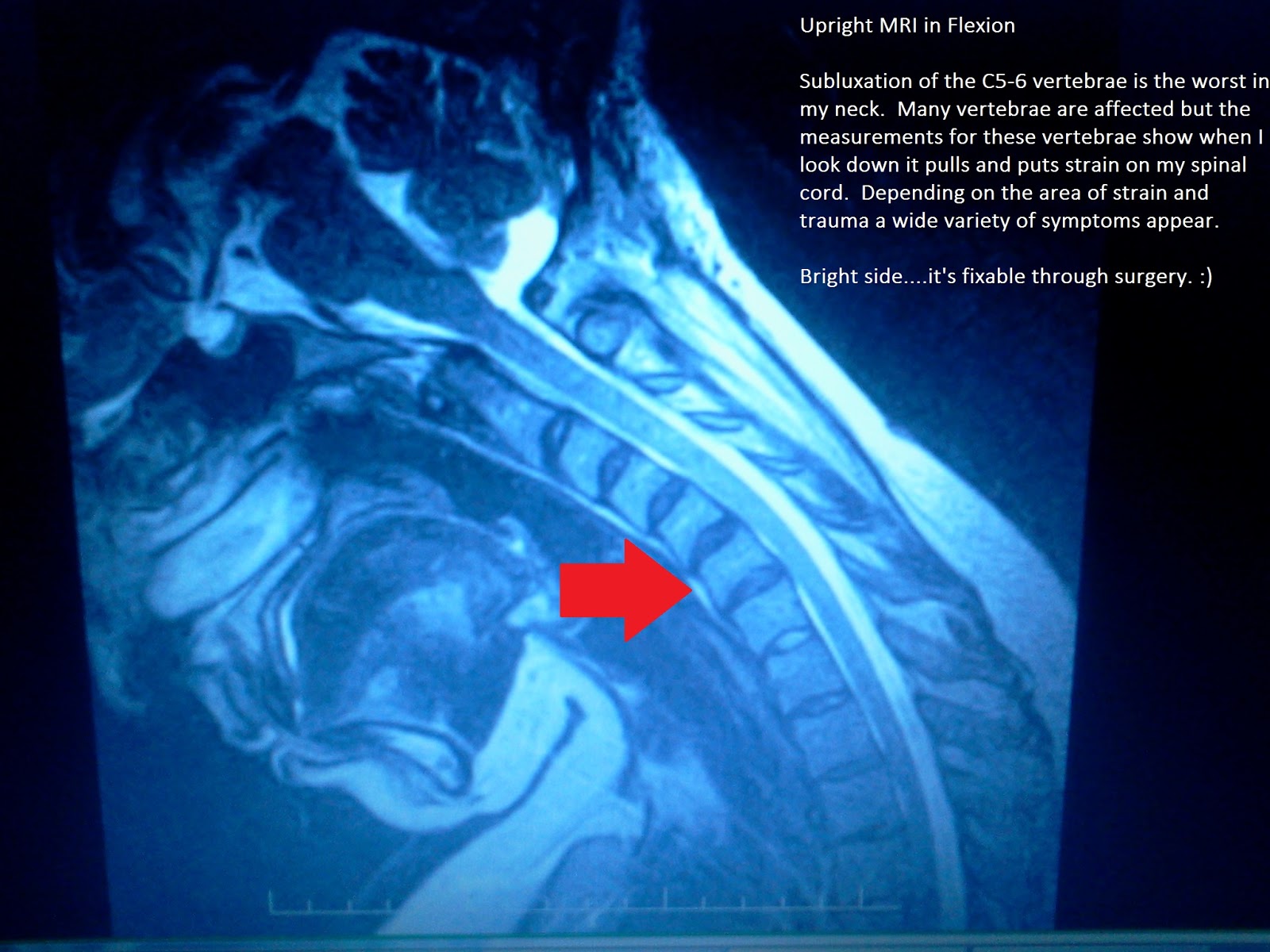 You know what drives me crazy? Burning Dendrites: You know what feels ...
