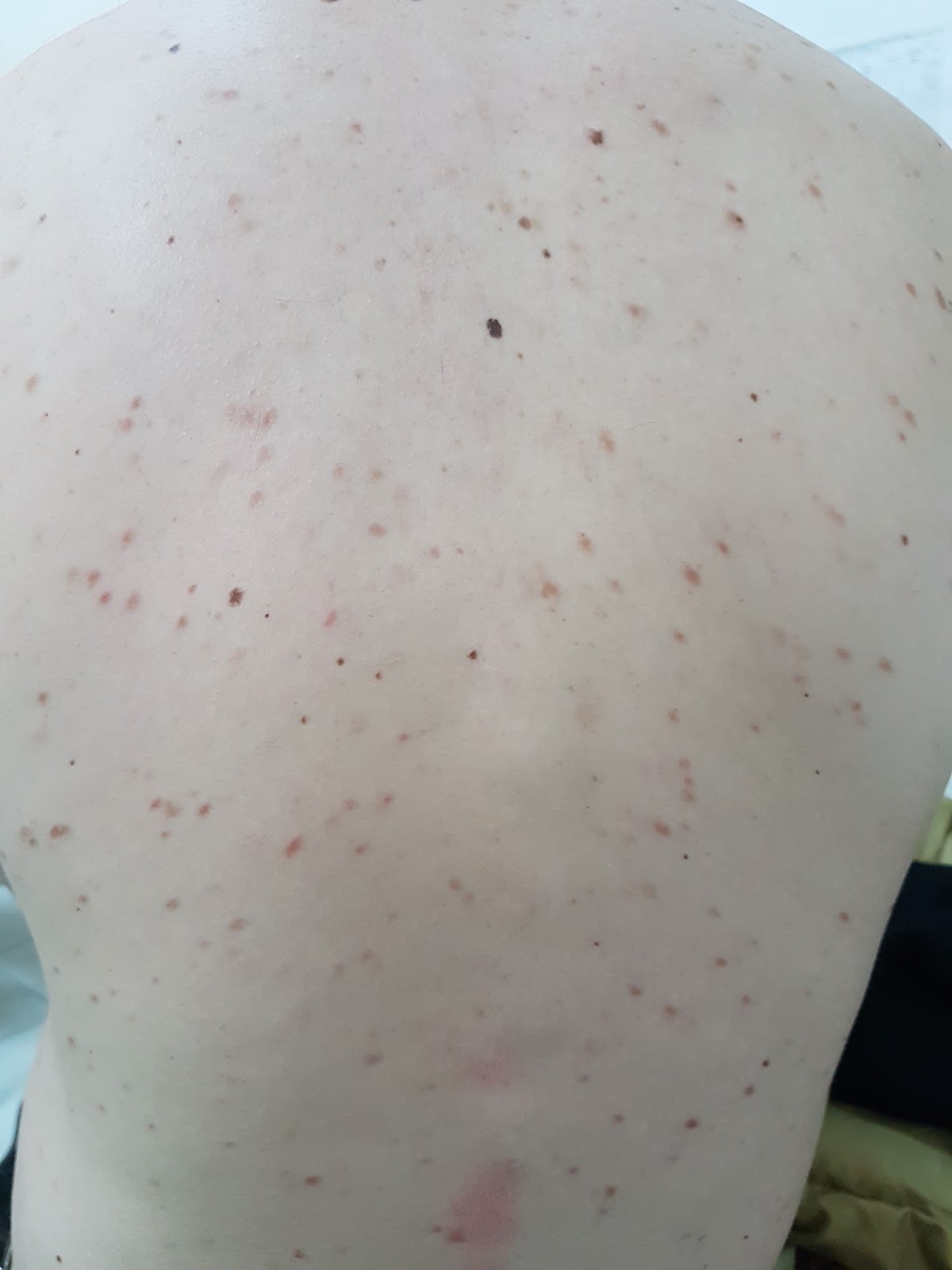 Dermatocosmetologie - sănătatea pielii tale