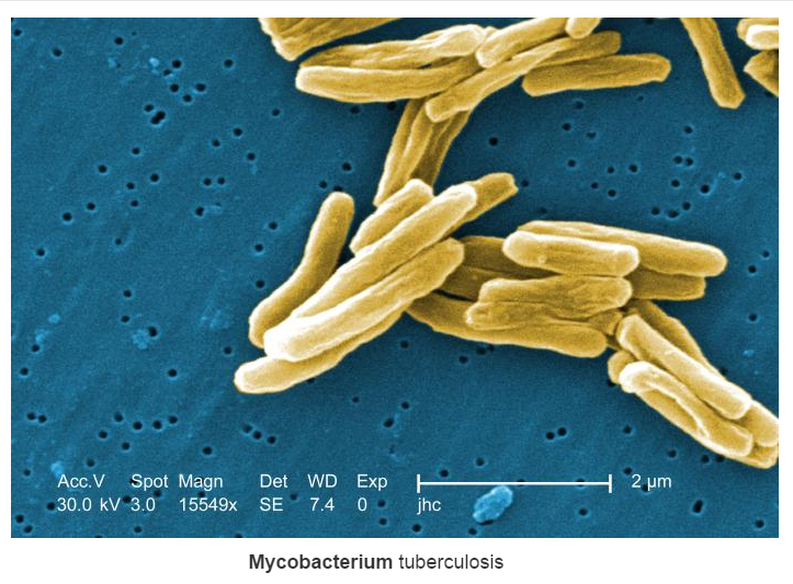 #55 Infectious diseases and Antibiotics | Biology Notes for A level