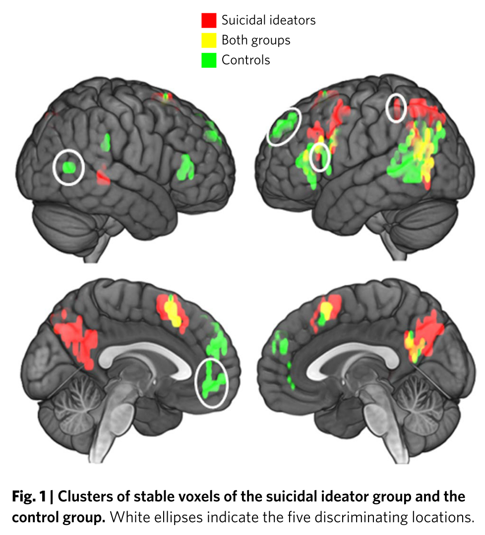 The Neurocritic: Can a Computer Algorithm Identify Suicidal People from ... The Neurocritic: Can a Computer Algorithm Identify Suicidal People from ...
