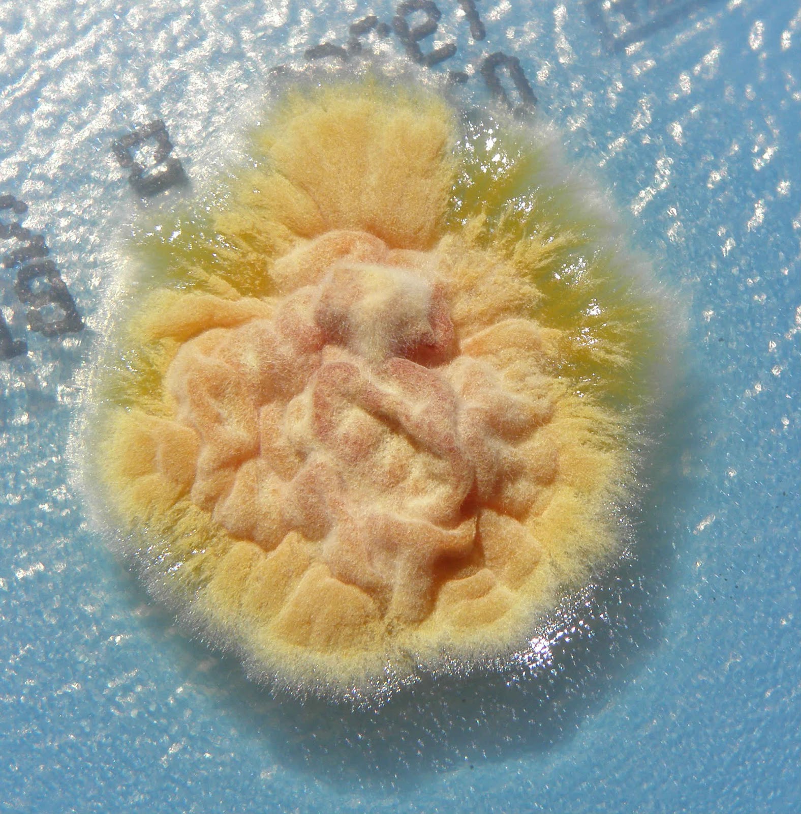 ATLAS MICOLOGIA: TRICHOPHYTON SOUDANENSE