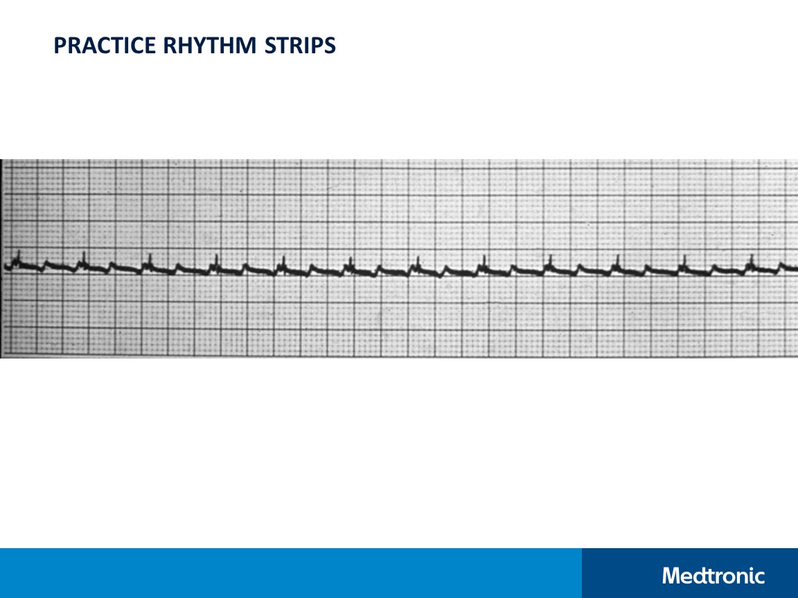 CVT Mohd Farid: Heart Rhythm Interpretation Part II-Medtronic Academy