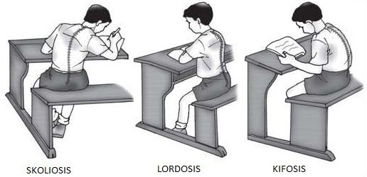 Macam-macam Penyakit, Gangguan dan Kelainan Pada Tulang dan Persendian ...