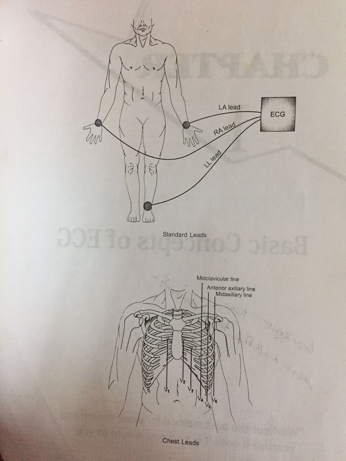 BASIC CONCEPTS OF ECG