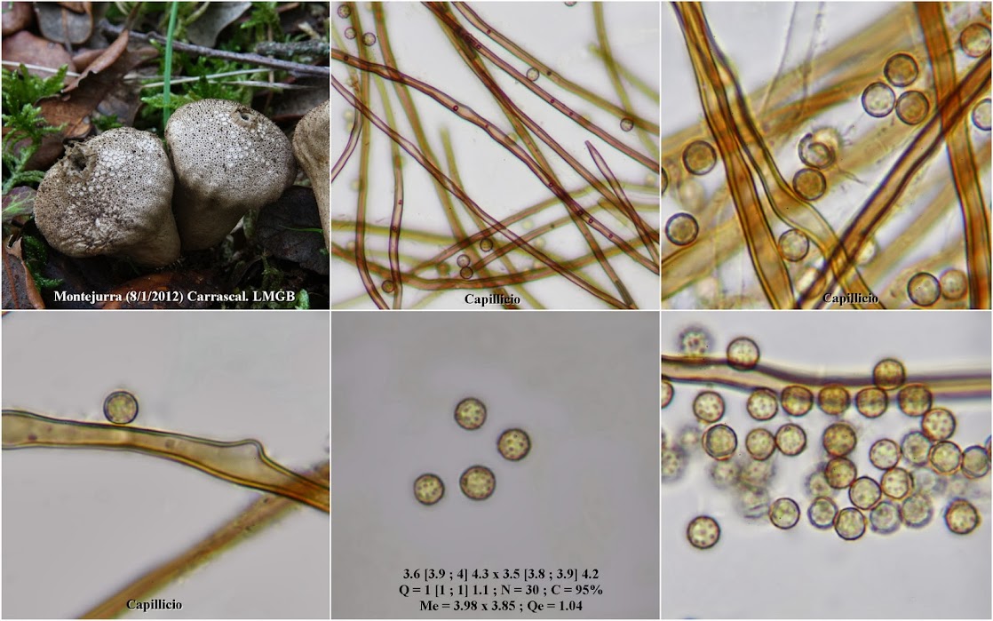 Microscopía de hongos. Vol 3. L - N: Lycoperdon perlatum