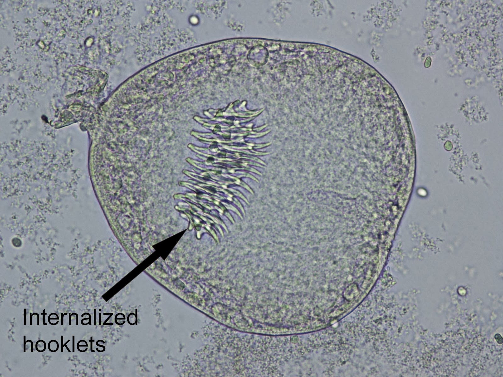 Creepy Dreadful Wonderful Parasites: Answer to Case 280