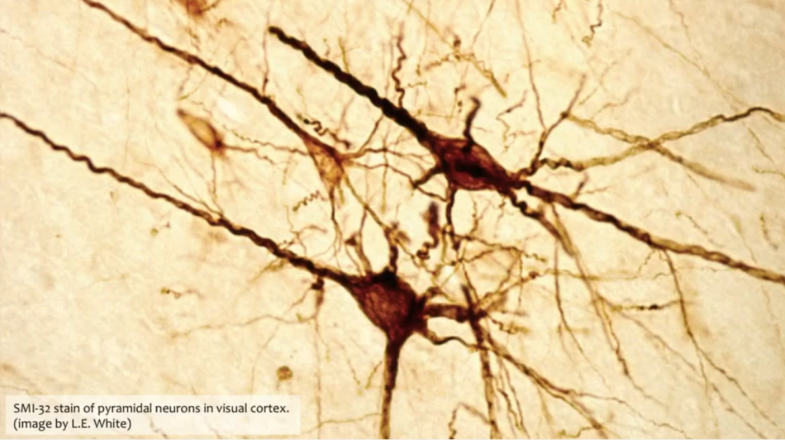 Ciencias Naturales 1er Bim.