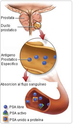 Urología Peruana: Dr. Susaníbar: Conociendo al antígeno prostático